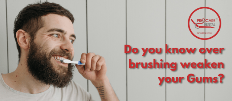 Do you know over brushing weaken your Gums?